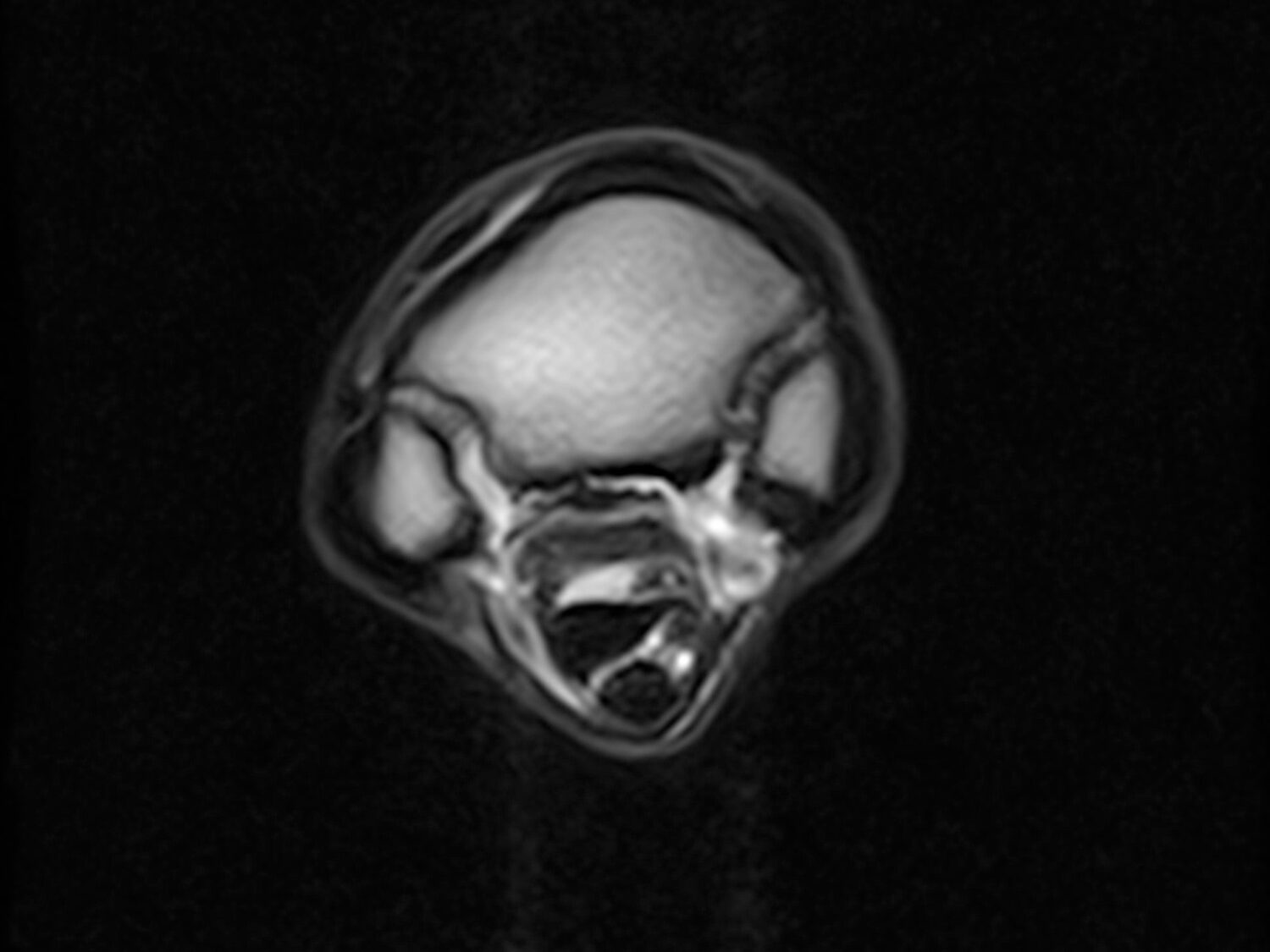 Standing Equine MRI for Horses | Hallmarq Veterinary Imaging