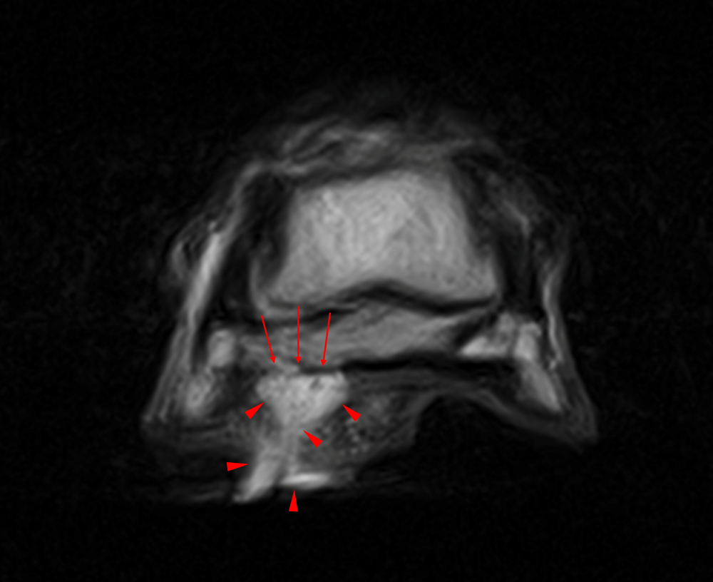 Persistently draining solar abscess from right hind foot - Hallmarq ...