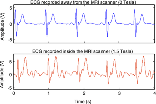 Anesthetic Management for the Small Animal MRI Patient - Hallmarq ...