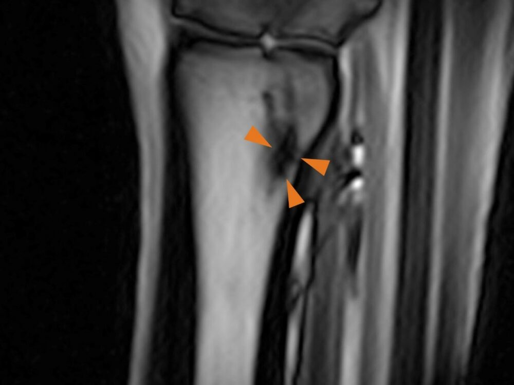 Standing CT Scanner for Horses | Hallmarq Veterinary Imaging