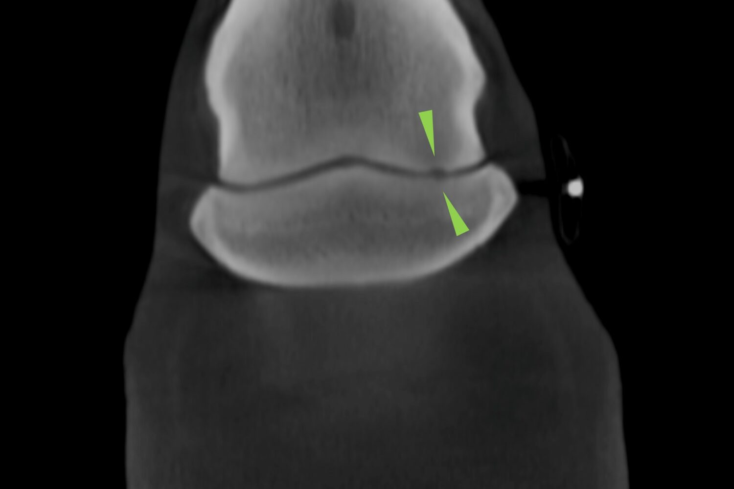 Standing CT Scanner for Horses | Hallmarq Veterinary Imaging