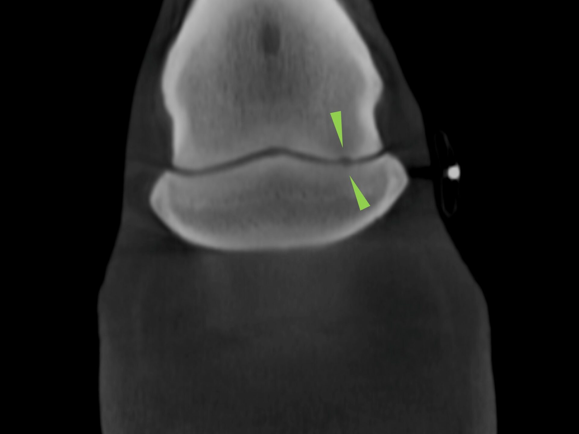 Standing CT Scanner for Horses | Hallmarq Veterinary Imaging