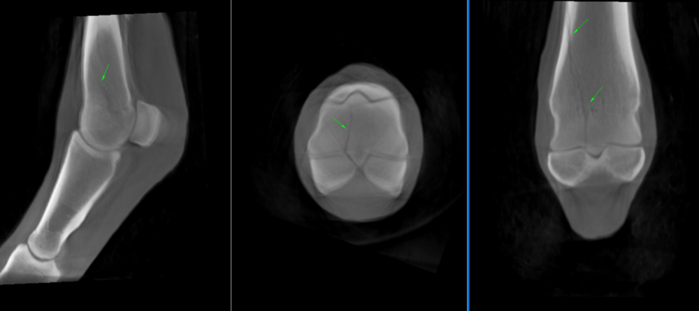 Lateral condylar and lateral proximal sesamoid fractures - Hallmarq ...