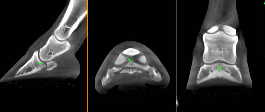 Contrast arthrogram of the distal interphalangeal joint - Hallmarq ...