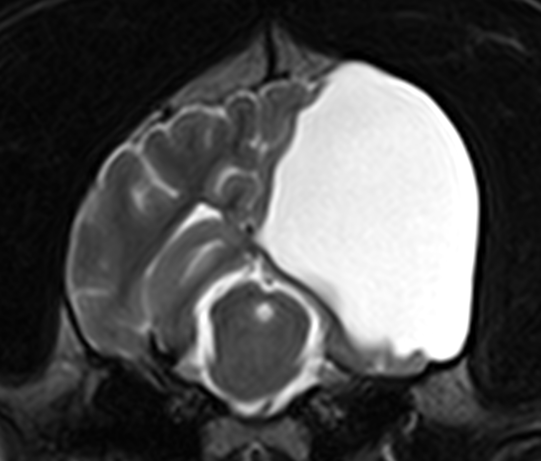 Canine hydranencephaly - Hallmarq Veterinary Imaging