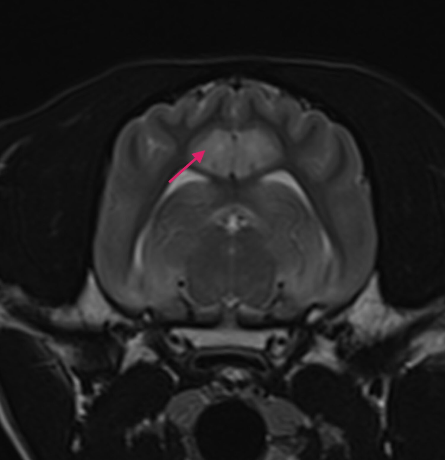 Understanding the Post-Ictal Paradox - Hallmarq Veterinary Imaging