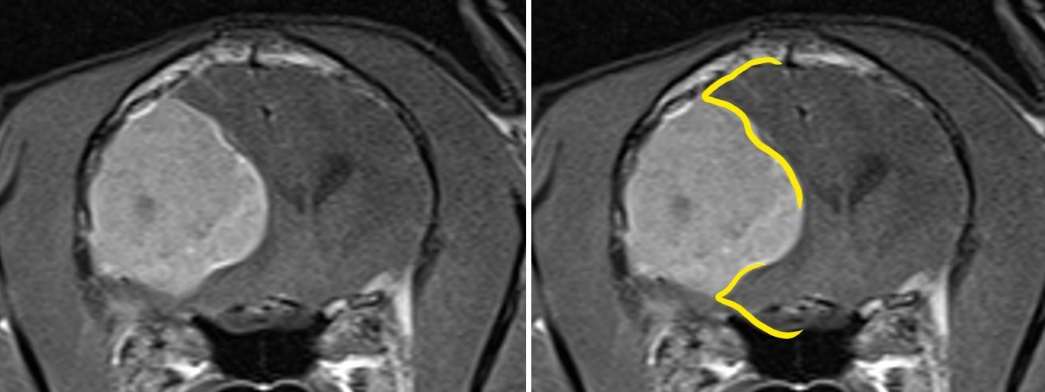Pareidolia in MRI: finding hidden patterns in medical imaging ...