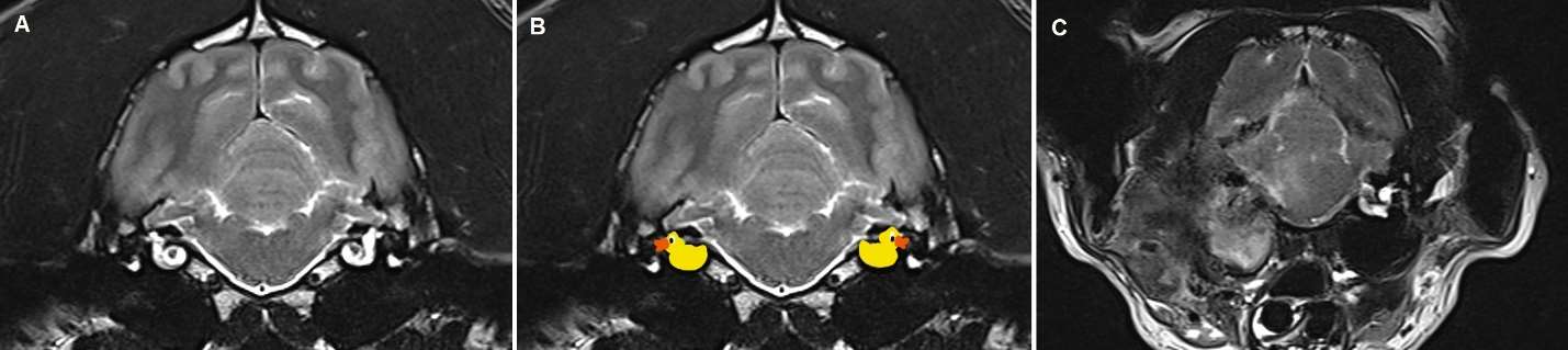 Pareidolia in MRI: finding hidden patterns in medical imaging ...