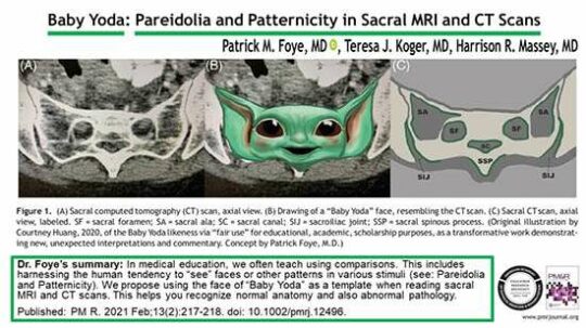 Pareidolia in MRI: finding hidden patterns in medical imaging ...